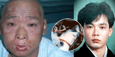 Hisashi Ouchi fotos reales: Circulan de nuevo las imágenes del trágico ...
