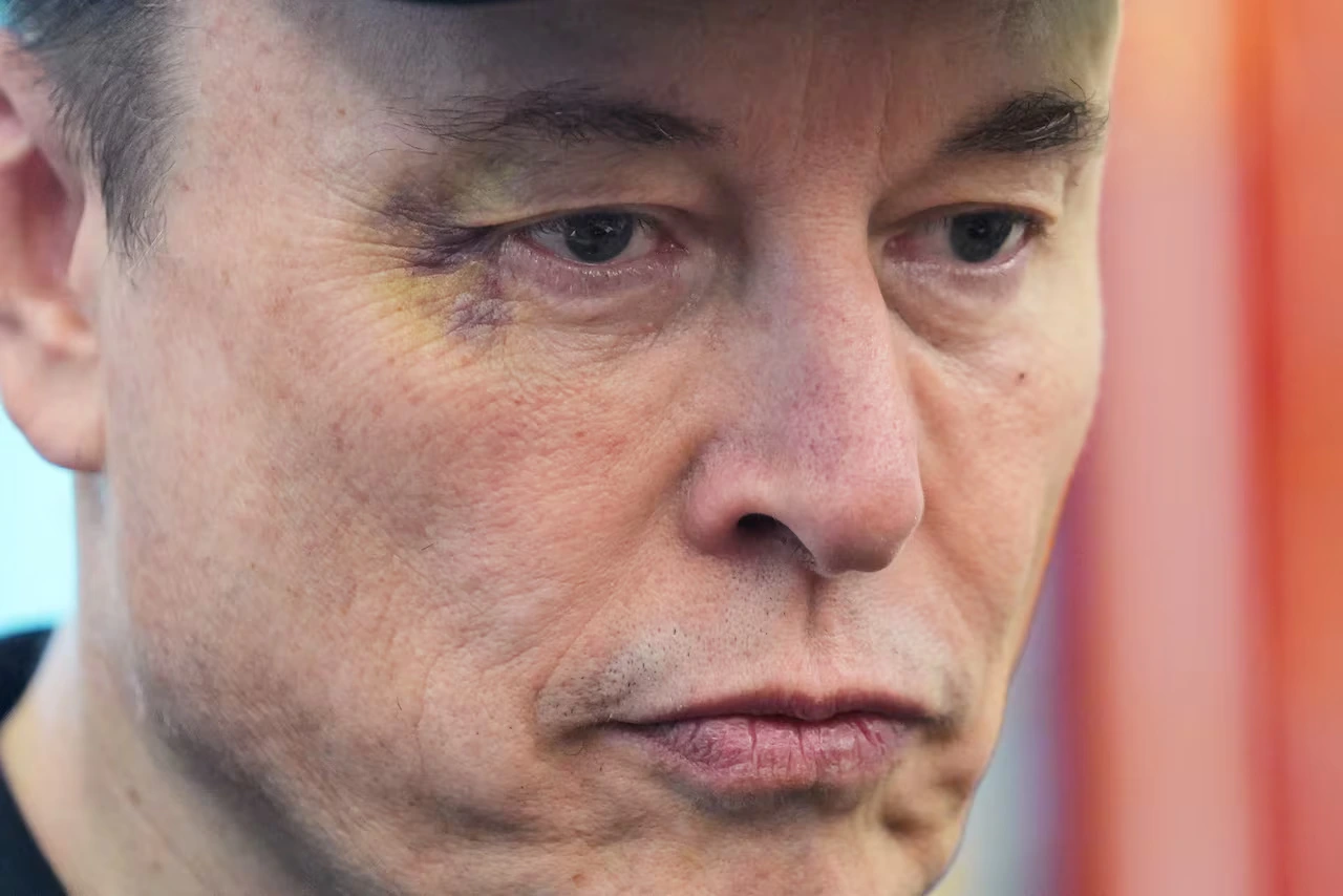 Elon Musk aparece con un ojo morado en su salida de la Casa Blanca ...